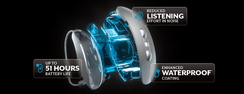 Starkey Omega AI from a Best Practices Audiologist